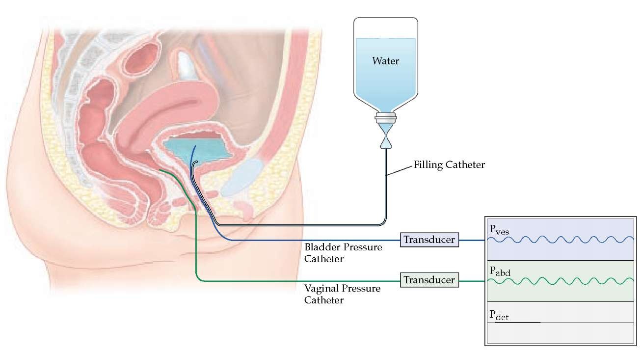 Urodynamic Testing Womens Excellence Lake Orion Clarkston